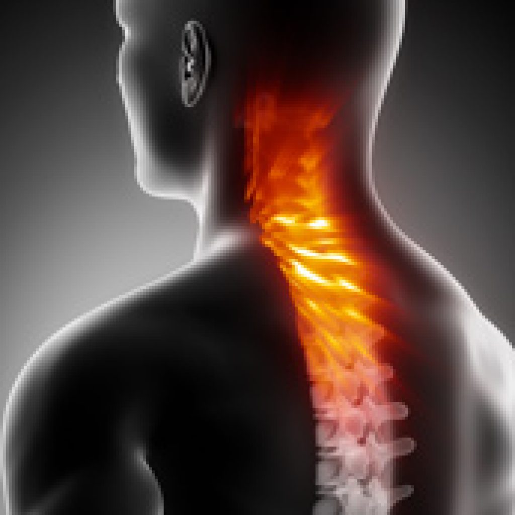 Bone Spurs | New Jersey Spine Specialists